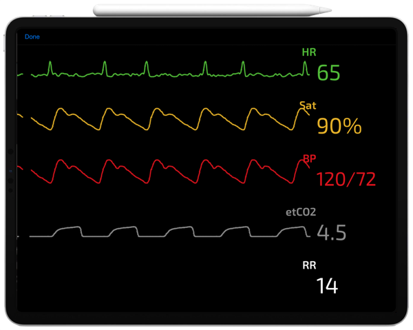 SimMon Medical Simulation App